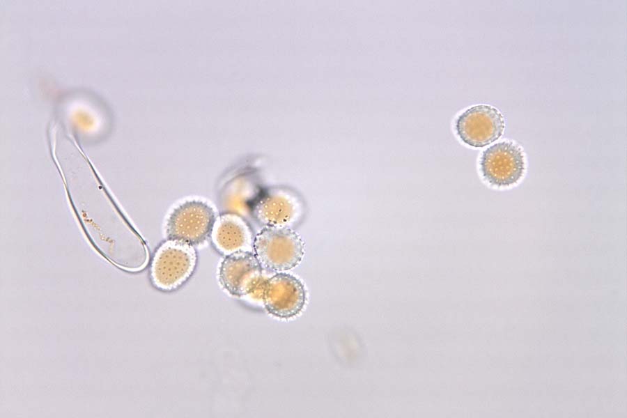 Himbeerrost (Phragmidium rubi-idaei)